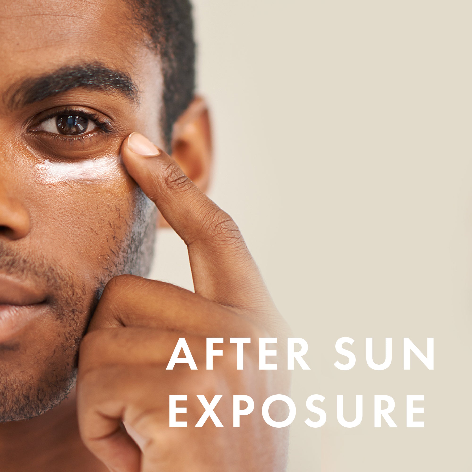 After Sun Exposure – Dr Jackson's US
